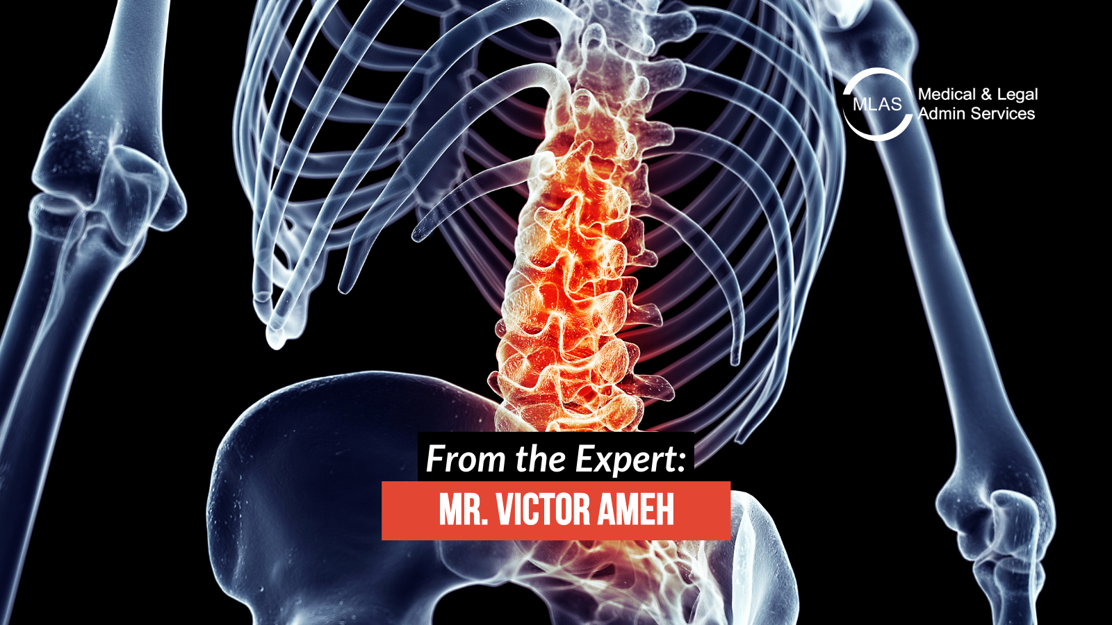 Cauda Equina Syndrome in the Emergency Department: A 2-year Single ...